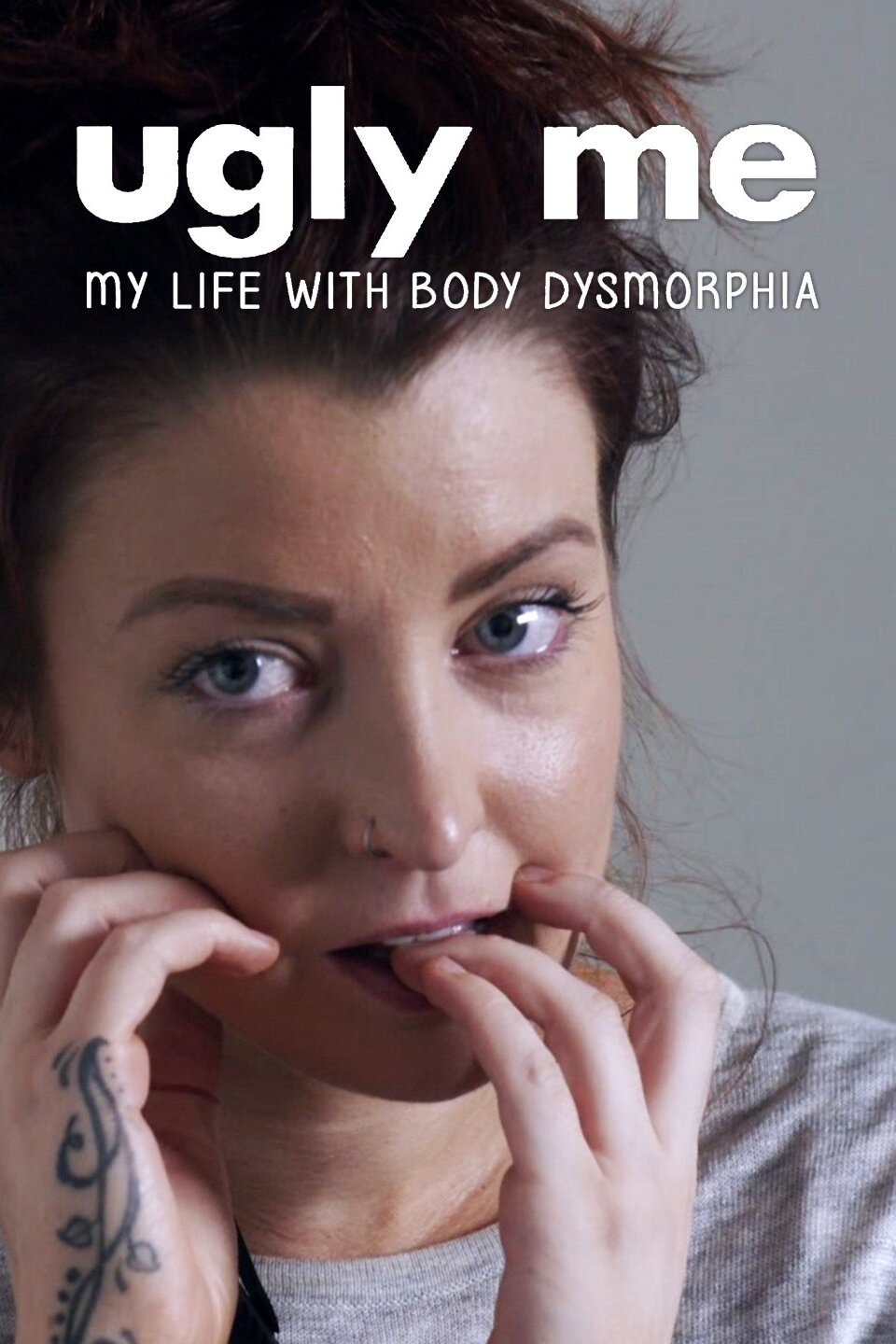 Ugly Me: My Life with Body Dysmorphia